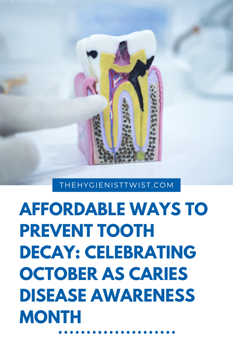 Affordable Ways to Prevent Tooth Decay: Celebrating October as Caries ...